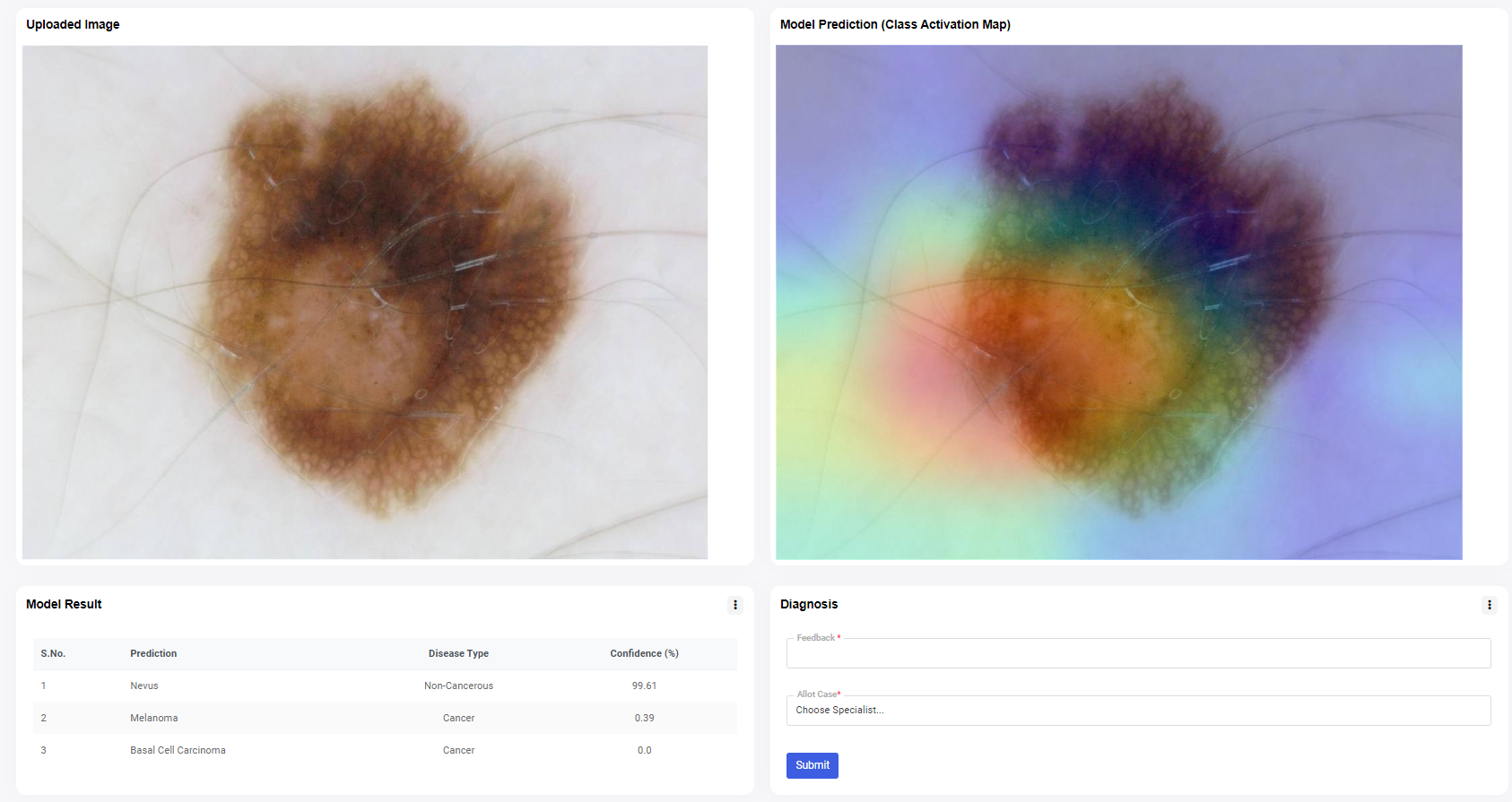 Skin Cancer Detection Web App Using Flask Python And Mysql Wisdom Ml